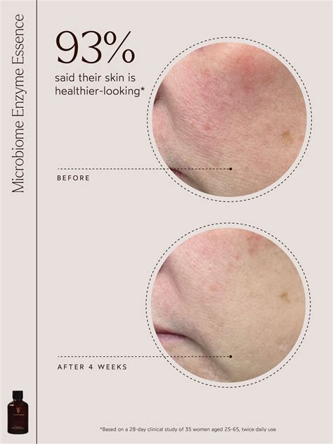 Microbiome Enzyme Essence True Botanicals