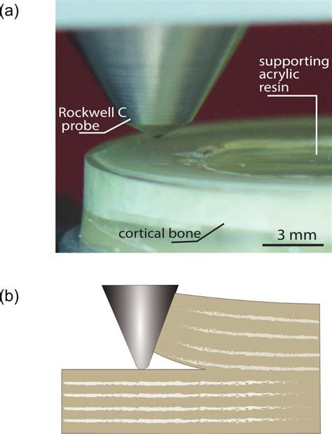 Fragility Assessment Of Bovine Cortical Bone Using Scratch Tests Protocol
