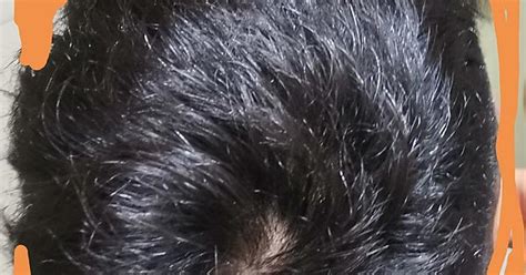 Diffuse Thinning Album On Imgur