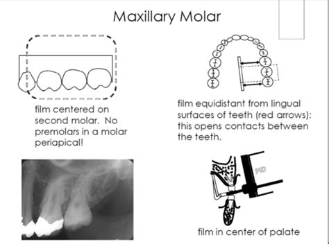 Paralleling Technique Chapter 17 Flashcards Quizlet