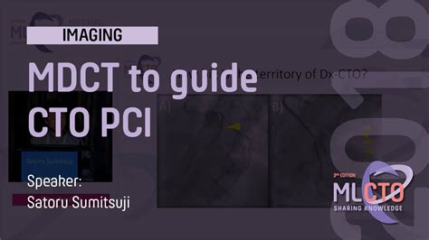 Mdct To Guide Cto Pci Mlcto Academy