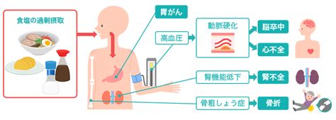 ひとめで分かる塩分量 減塩の為の塩分バランスチェック食塩摂取量検査キット ユーグレナマイヘルス