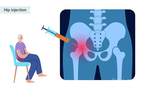 Hip Joint Injection 7 Photograph By Science Photo Library Pixels Merch