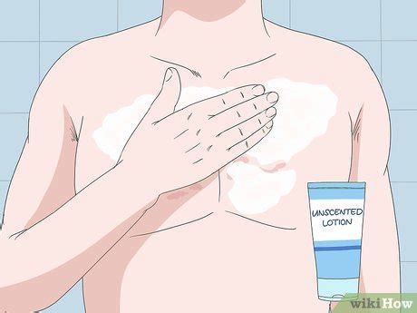 3 Simple Ways To Avoid Triggers For Chronic Hives WikiHow Health 3 Simple Ways To Avoid Triggers For Chronic Hives WikiHow Health