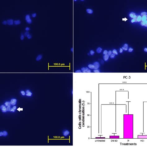 Dapi Staining Of Nuclei Indicating Chromatin Condensation In Pc 3 Download Scientific Diagram