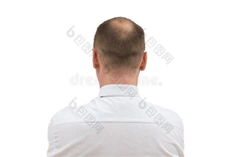 人秃头症或头发损失成熟的男人手佃户租种的 包图企业站
