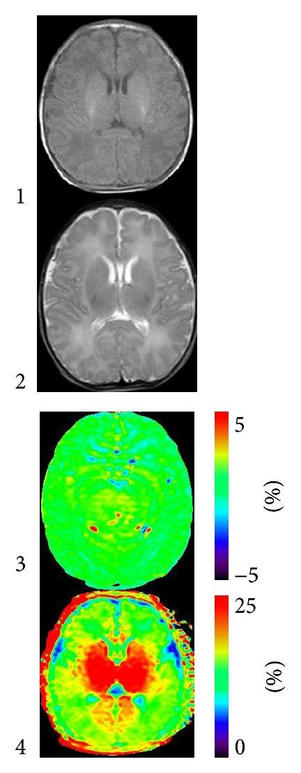 Axial Images From Examples Of Neonatal Brain Mri At Different Corrected Download Scientific