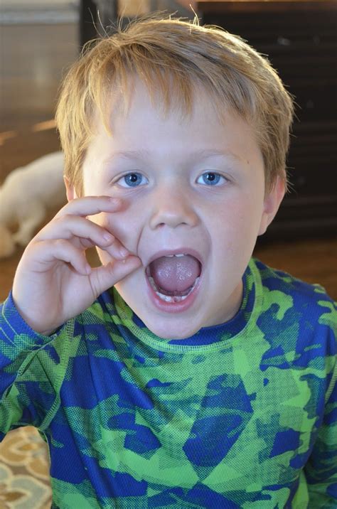 The Karaffas Breckens 1st Tooth Lost