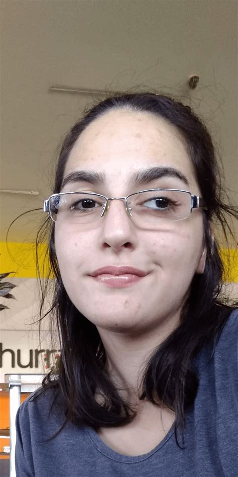 I Went From Esotropia To Exotropia When I Had My Surgery In 2005 R Strabismus