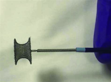 Ventricular Septal Defect Occluder Device Attached To Delivery System Download Scientific Diagram