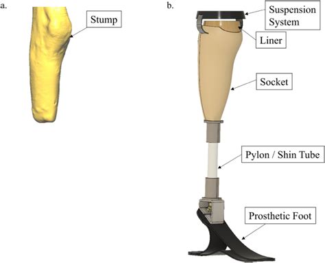 Hybrid Multi Criteria Decision Making Approaches For Transtibial