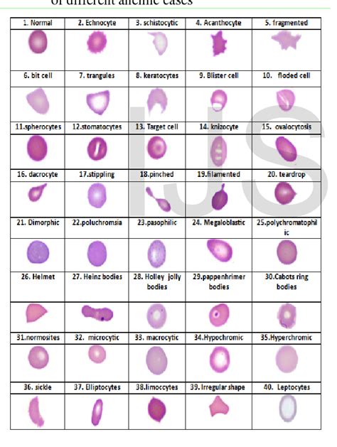 Table 2 From Frequency Rate Of Abnormal Morphologic Shapes Of The
