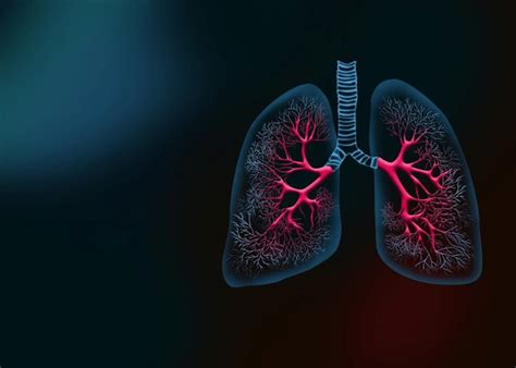 Apical Pneumonia Over 7 Royalty Free Licensable Stock Illustrations