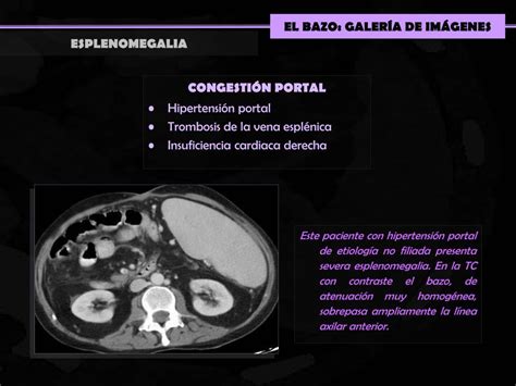 Ppt El Bazo Galer A De Im Genes Powerpoint Presentation Free