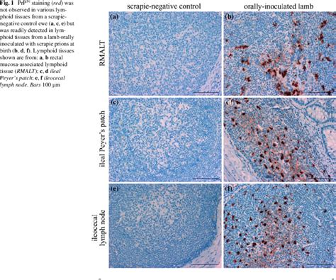 Prp Sc Staining Red Was Not Observed In Various Lymphoid Tissues From Download Scientific