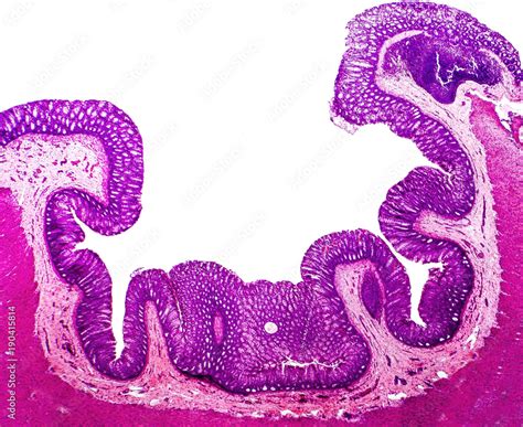 Poster Histology Of Human Appendix Cross Section Micrograph Showing Epithelium And Crypts Of