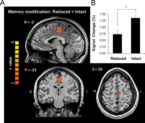 Cortico Subcortical Neuronal Circuitry Associated With Reconsolidation Of Human Procedural