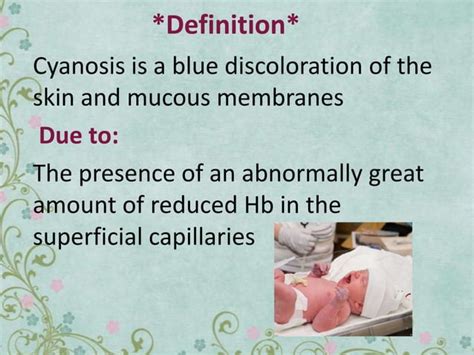 Cyanosis Ppt