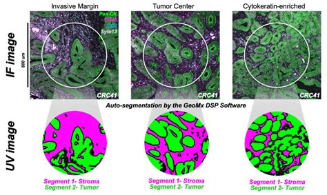 The Most Flexible Spatial Solution GeoMx DSP