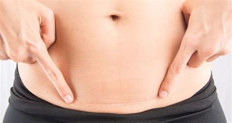 40 Best Ways To Get Rid Of Acne Scabs Overnight Artofit