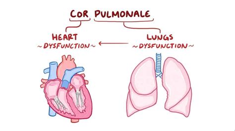 Cor Pulmonale Video Causes And Meaning Osmosis