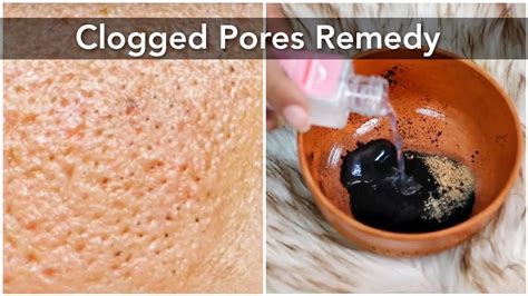 Clogged Pores