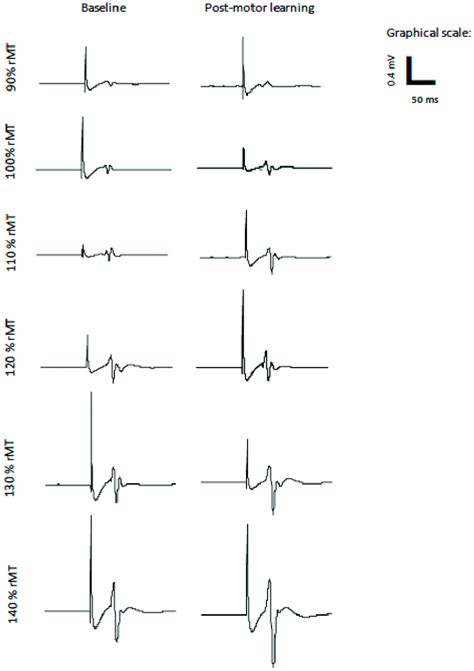 Average Mep Data At Baseline And Post Motor Learning From A