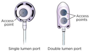 About Your Implanted Port Information For Pediatric Patients