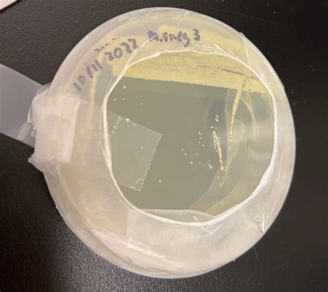 Microbiology What Microbial Contaminant Grows Blue On L Agarl Broth