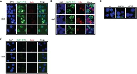 Ifi16 Partners With Kap1 To Maintain Epstein Barr Virus Latency Pmc