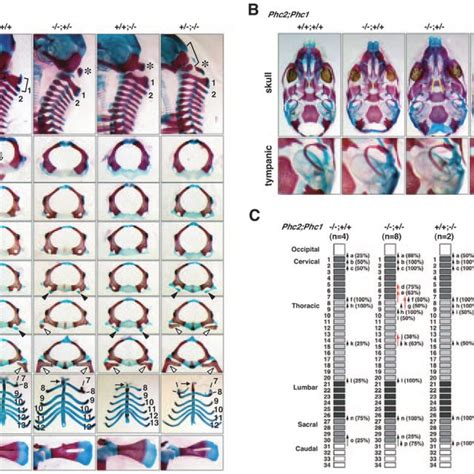 Skeletal Alterations In Phc2 Ϫ Ϫ Mice And Gene Dose Dependent