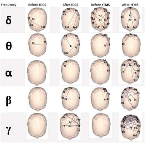 2 Change In Functional Connectivity From An EEG Based Analysis In Download Scientific Diagram