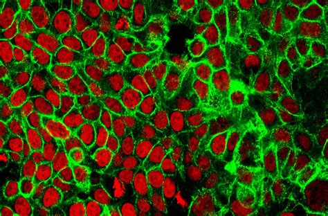 A Machine Learning Tool Can Help With Diagnosing Monitoring Colorectal Cancer