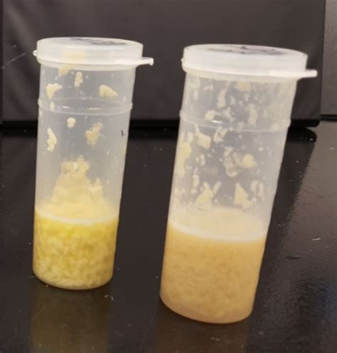 Mastitis Quiz 21 Flashcards Quizlet