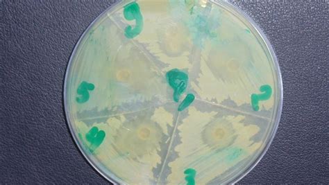 2 And 3 Inhibition Bacterial Growth Zones By Bacteriocin Of P