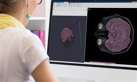 Free Course Image Segmentation Filtering And Region Analysis From