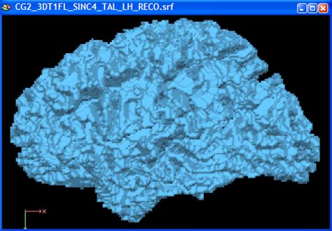 Surface Reconstruction Of The Cortical Sheet