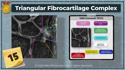 KOR Anatomy 15 Triangular Fibrocartilage Complex TFCC Wrist MRI