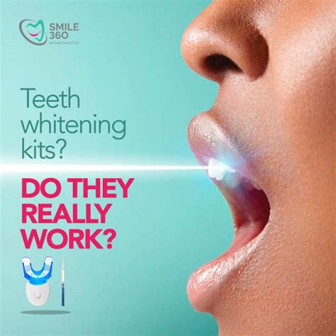 Teeth Whitening