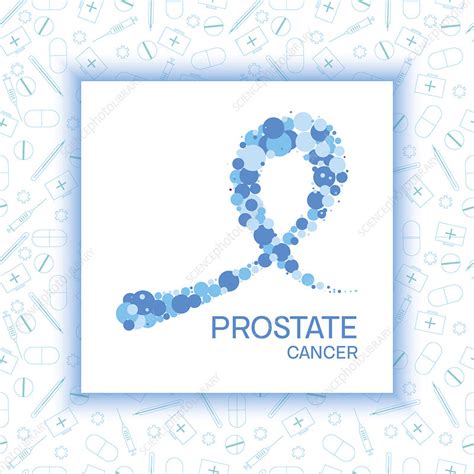 Prostate Cancer Illustration Stock Image F0323593 Science Photo Library