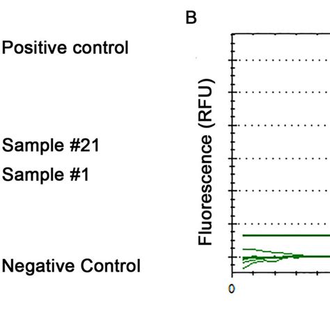 Real Time Detection Of Hcv Rna And Hiv 1 Proviral Dna Positive Controls