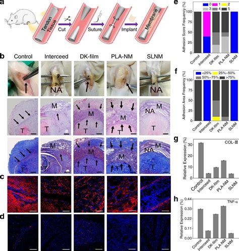 Development Of Nano Skin To Prevent Post Operative Adhesion