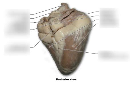 Real Heart Posterior Diagram Quizlet