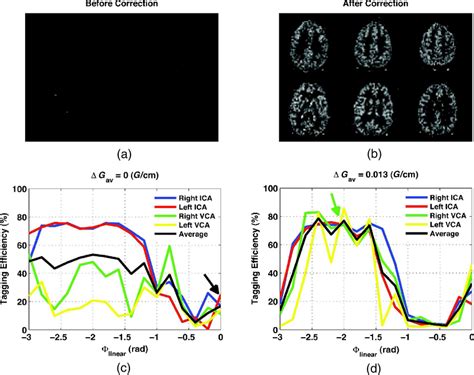 Perfusion Difference Images For Subject 1 Acquired Before A And After Download Scientific