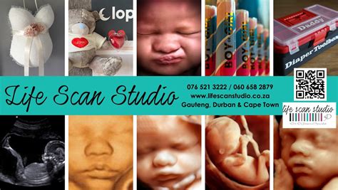 Ultrasound Scan 4d Hd Livetruview Imaging Is Here After A Long Wait The Demo Hd Live