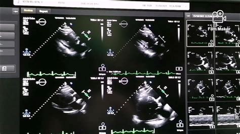 Rwma Findings In Lad Territory Mi Case Youtube