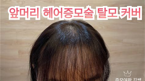 여자 앞머리 헤어 증모술 남자 여자 탈모 해결 Youtube