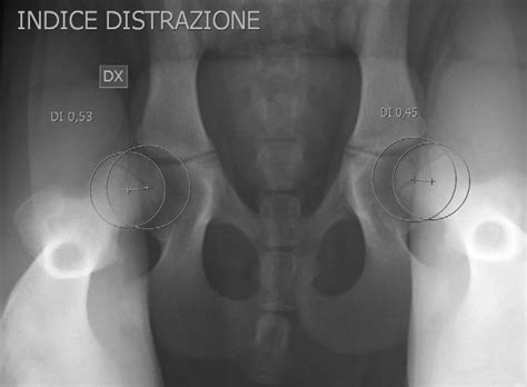 Дисплазия тазобедренного сустава 2021 ВКонтакте