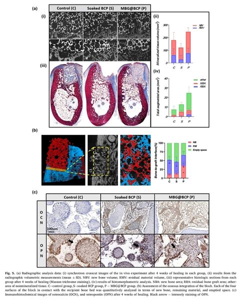 시공간적 약물 제어로 안정적 뼈 재생 플랫폼 개발암 골다공증 당뇨 환자 도움