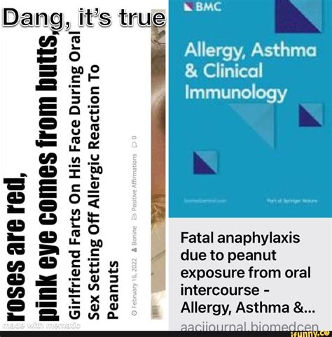 Anaphylaxis Memes Best Collection Of Funny Anaphylaxis Pictures On Ifunny